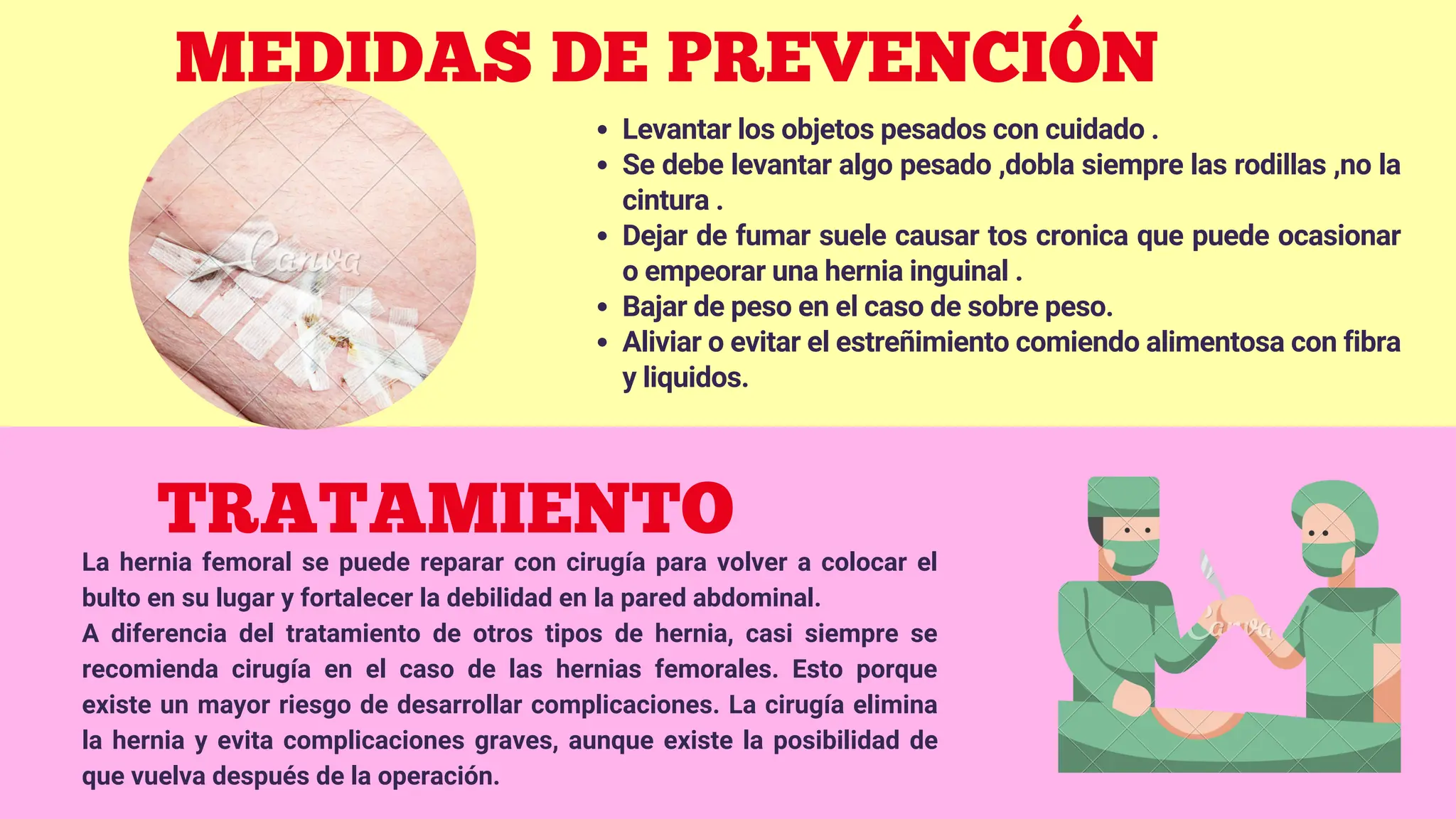 los tipos de hernia y cómo prevenirlo para evitar | PDF