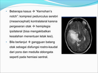 Herniasi Otak | PPT
