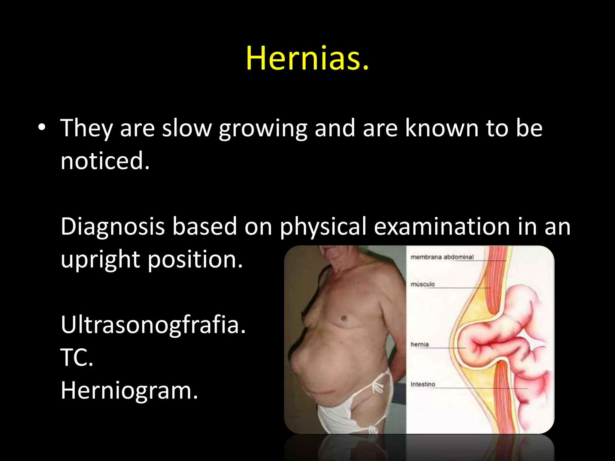 Hernias ingl | PPTX