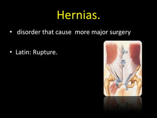Hernias ingl | PPTX