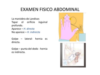 Hernias Inguinales Pptx