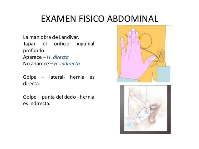 Hernia Inguinal Y Diabetes Tipo 2: Claves Diagnósticas – WARRMX