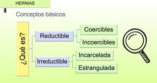 Hernias inguinales | PPTX