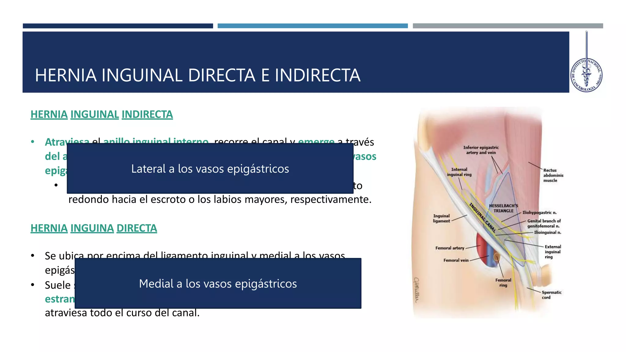 Hernias inguinales y de pared abdominal.pptx