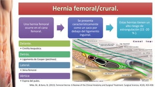 Hernias inguinales y femorales. | PPTX