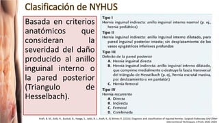 Hernias inguinales y femorales. | PPTX