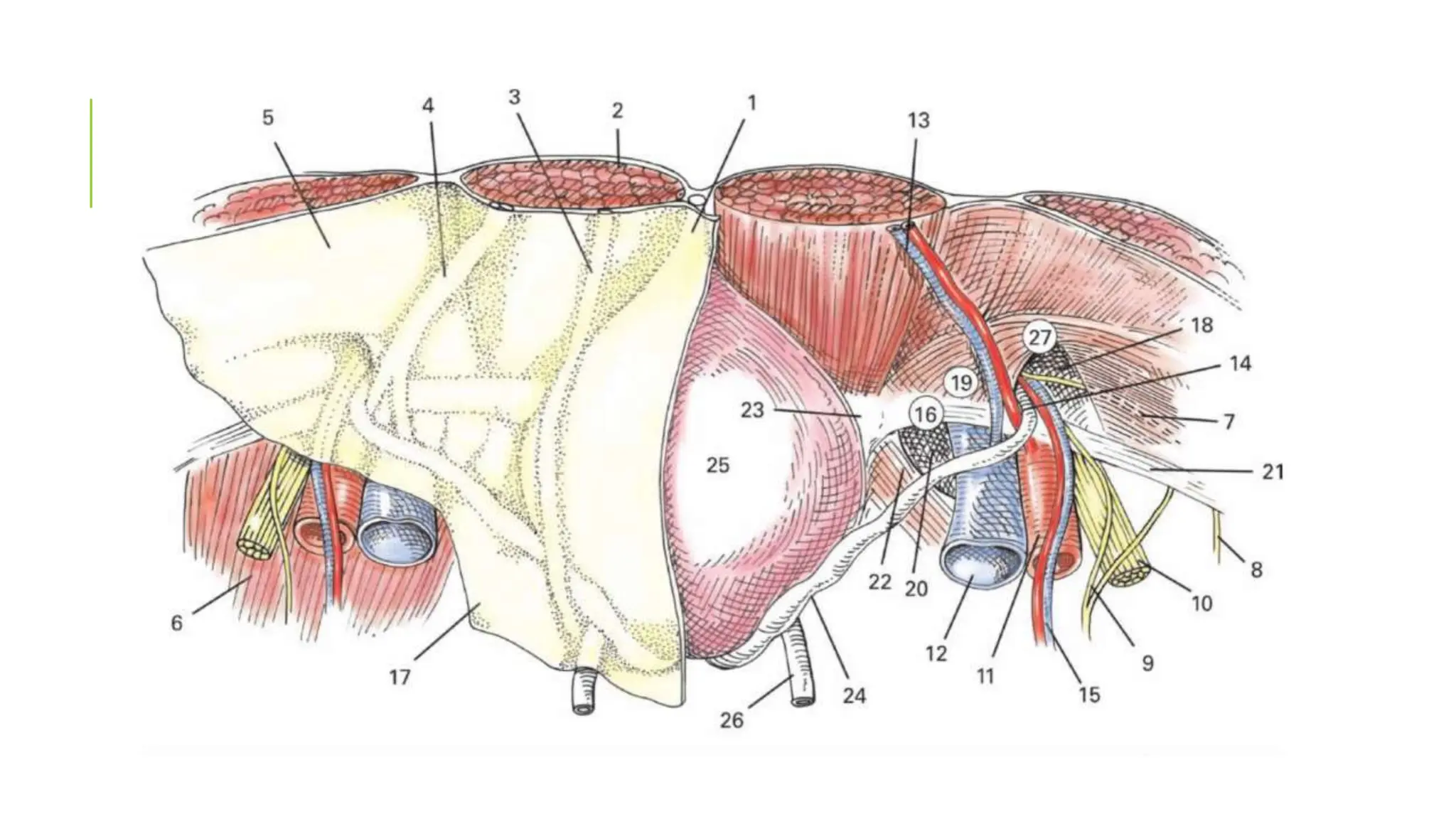 hernias inguinocrural. HERNIA HERNIA HERNIA HERNIA | PPTX | Death ...