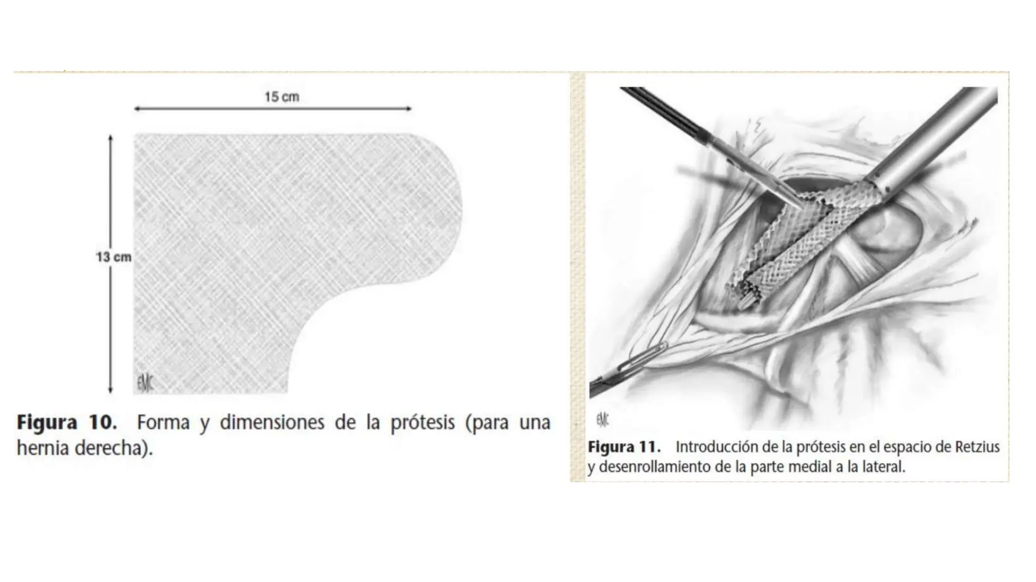 hernias inguinocrural. HERNIA HERNIA HERNIA HERNIA | PPTX | Death ...