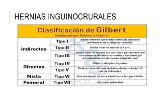 hernias inguinocrural. HERNIA HERNIA HERNIA HERNIA | PPTX