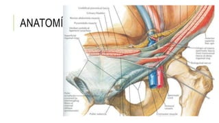 hernias inguinocrural. HERNIA HERNIA HERNIA HERNIA | PPTX