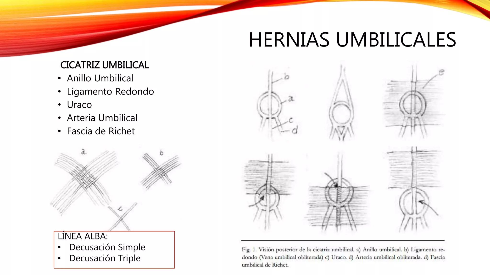 Hernias ventrales | PPTX