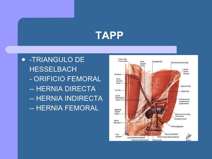Hernia Tapp