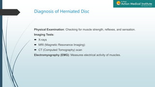 Herniated Disc Operation | Sri Balaji Action Medical Institute | PPTX