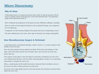 Herniated disc surgery | PPT