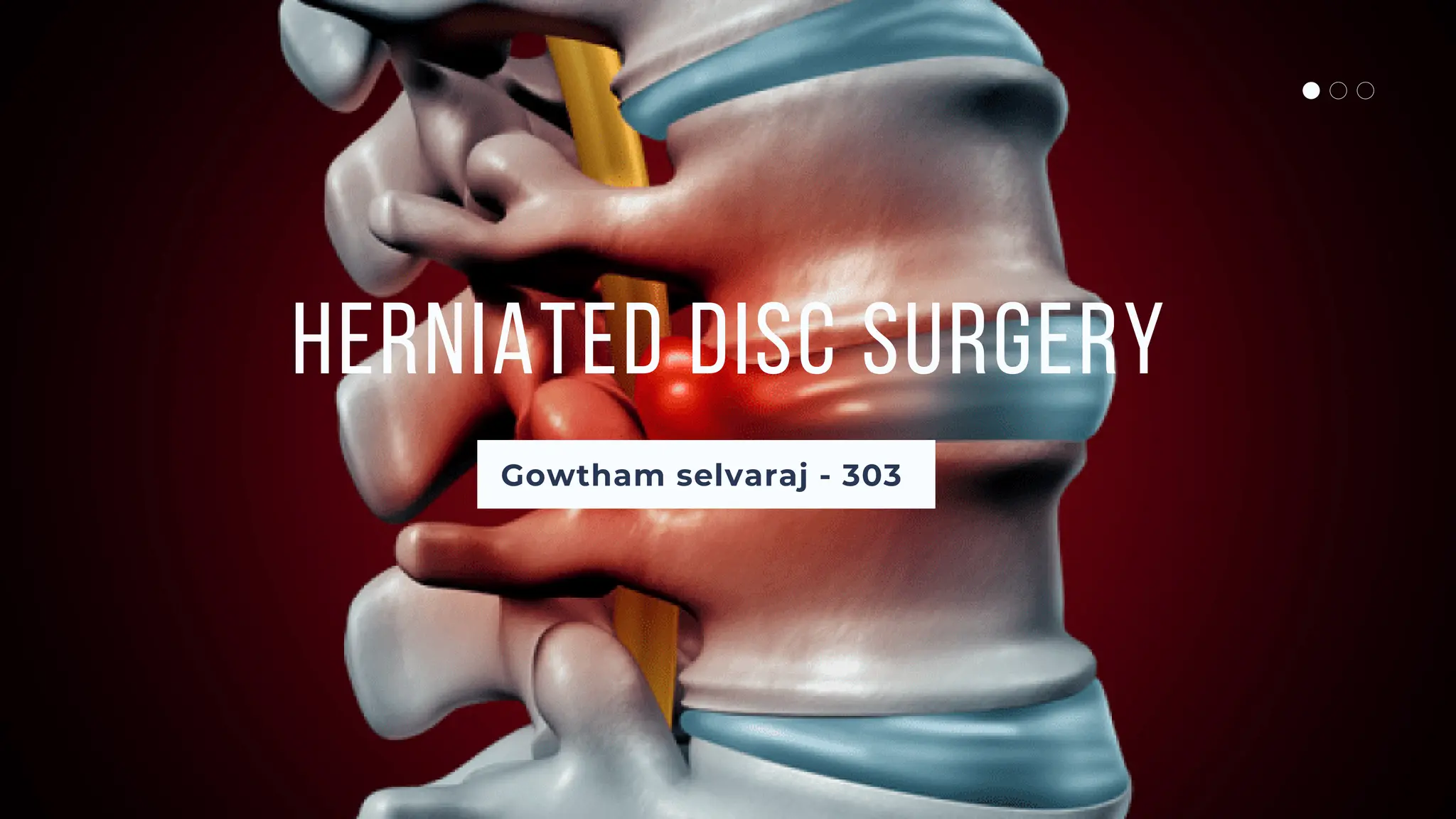 Herniated Disc Surgery( Gowtham 303).pdf