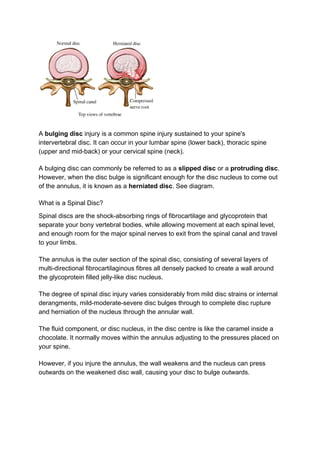 Herniated or protruded disk | PDF