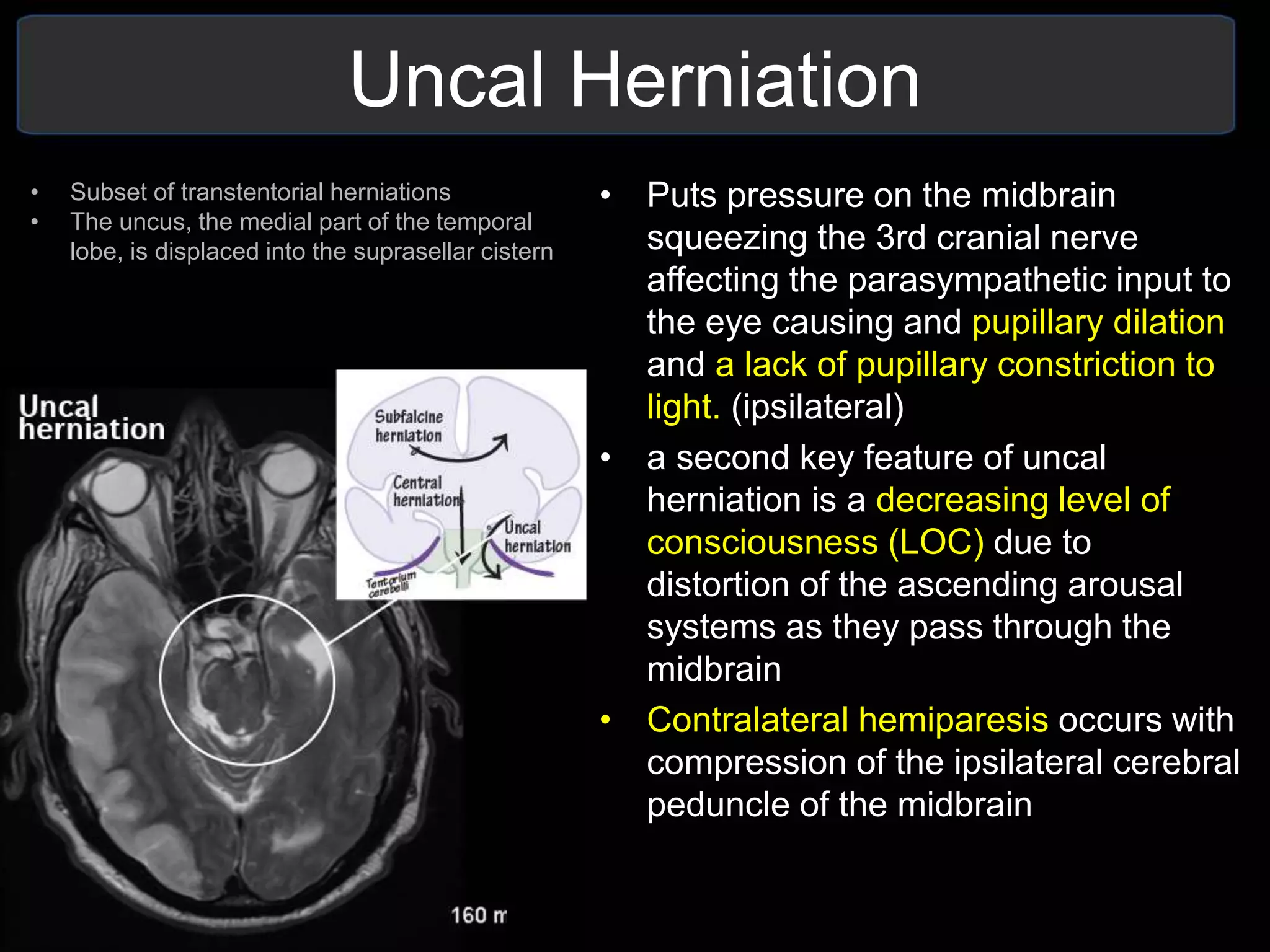 Herniation Syndromes Pptx