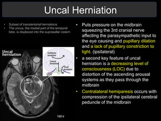 Herniation Syndromes | PPTX
