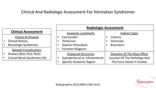 Herniation Syndromes - Neuro Imaging Master Series | PDF