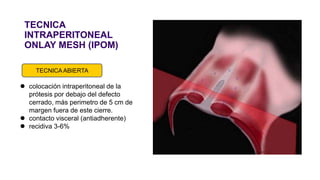 Hernia ventral colocacion de mallas.pptx