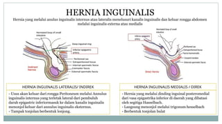 Hernia Hernia Hernia Hernia Hernia Hernia.pptx