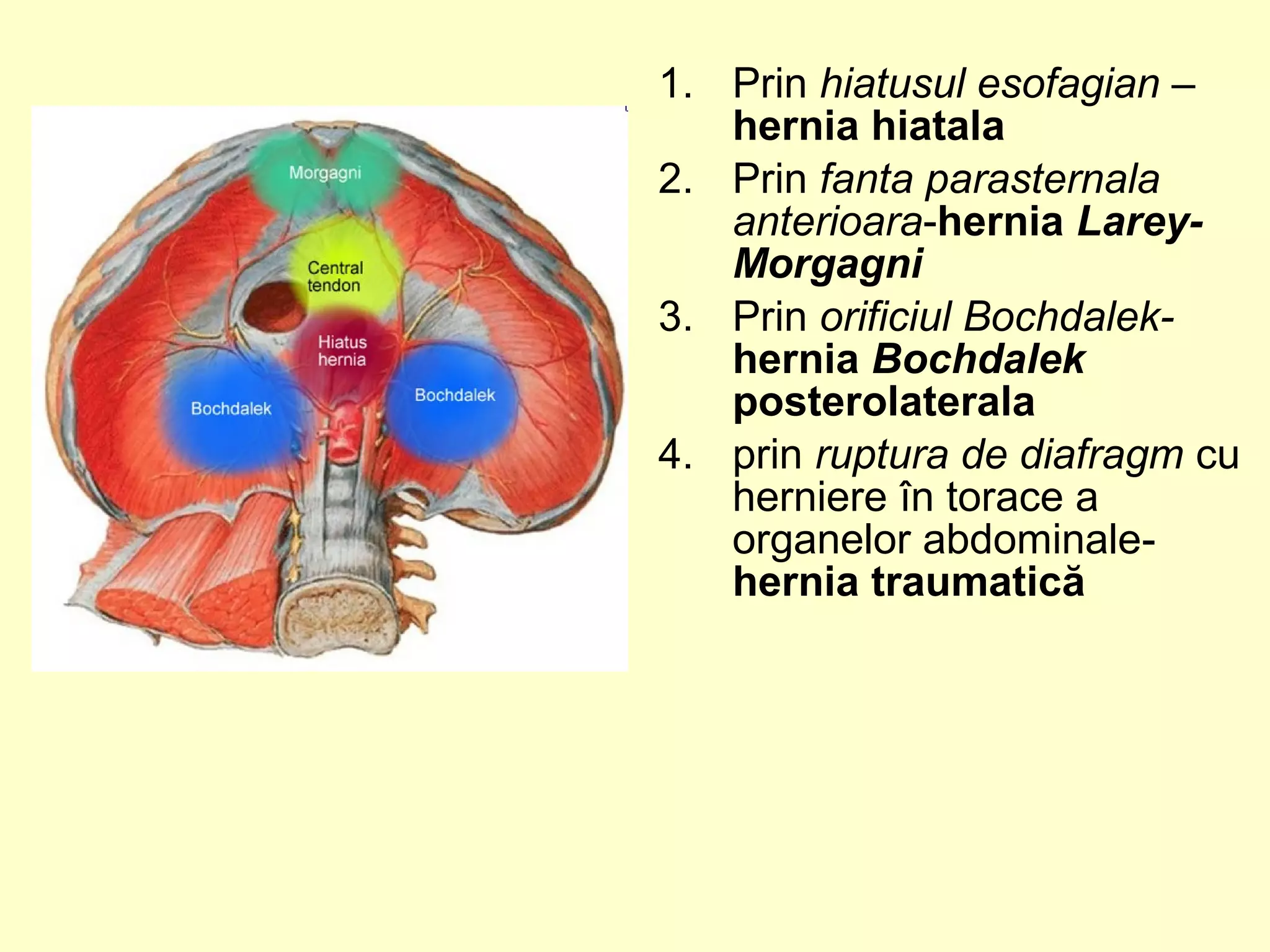 Hernii diafragmatice | PPT