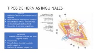 Técnica Quirúrgica Abierta para Hernioplastia Inguinal: Procedimientos ...