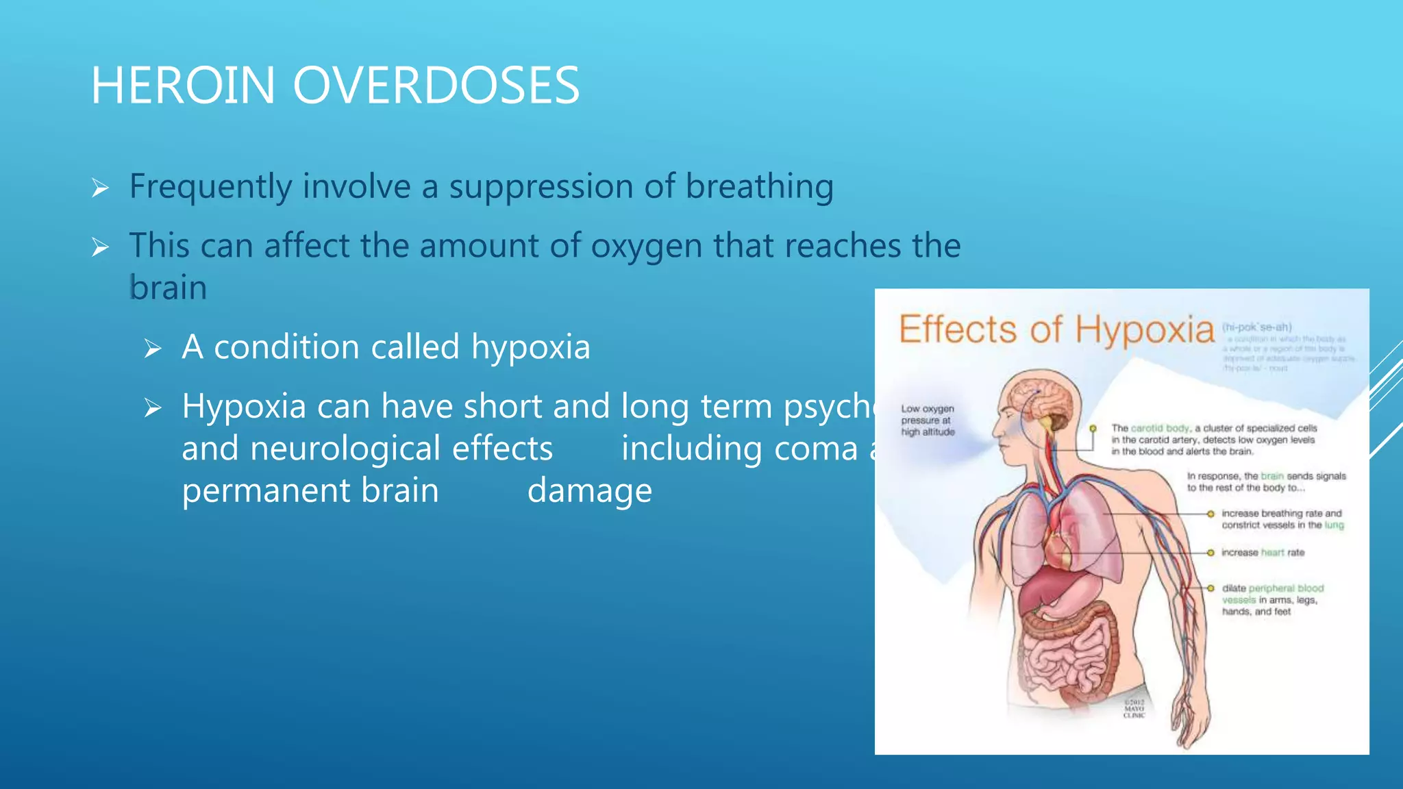 Heroin teachback | PPTX