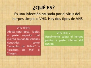 Herpes (VHS) | PPT