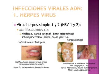 Herpes | PPTX