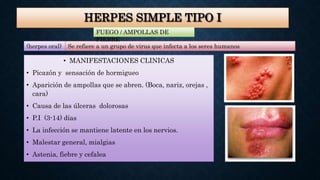Herpes | PPTX