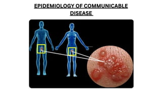 Herpes, Department of Physiotherapy, SHUATS | PPT