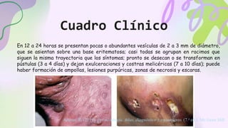 Herpes Diagnóstico Y Tratamiento Dermatología Pptx