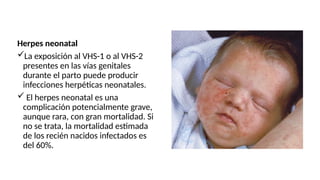 Herpes. Definicion, clasificacion, diagnostico | PPTX