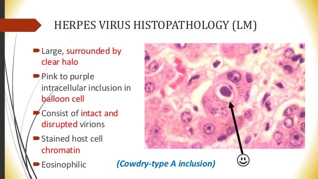 Herpes and cmv
