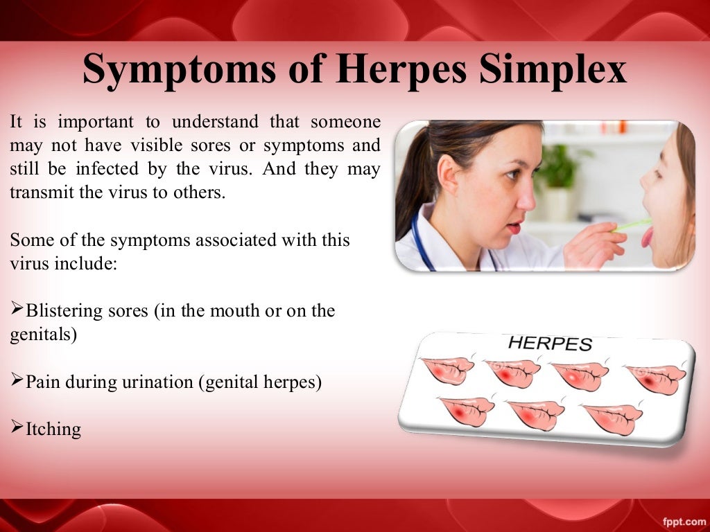 Genital Herpes - Facts on Causes, Symptoms & Diagnosis of Herpes Simplex