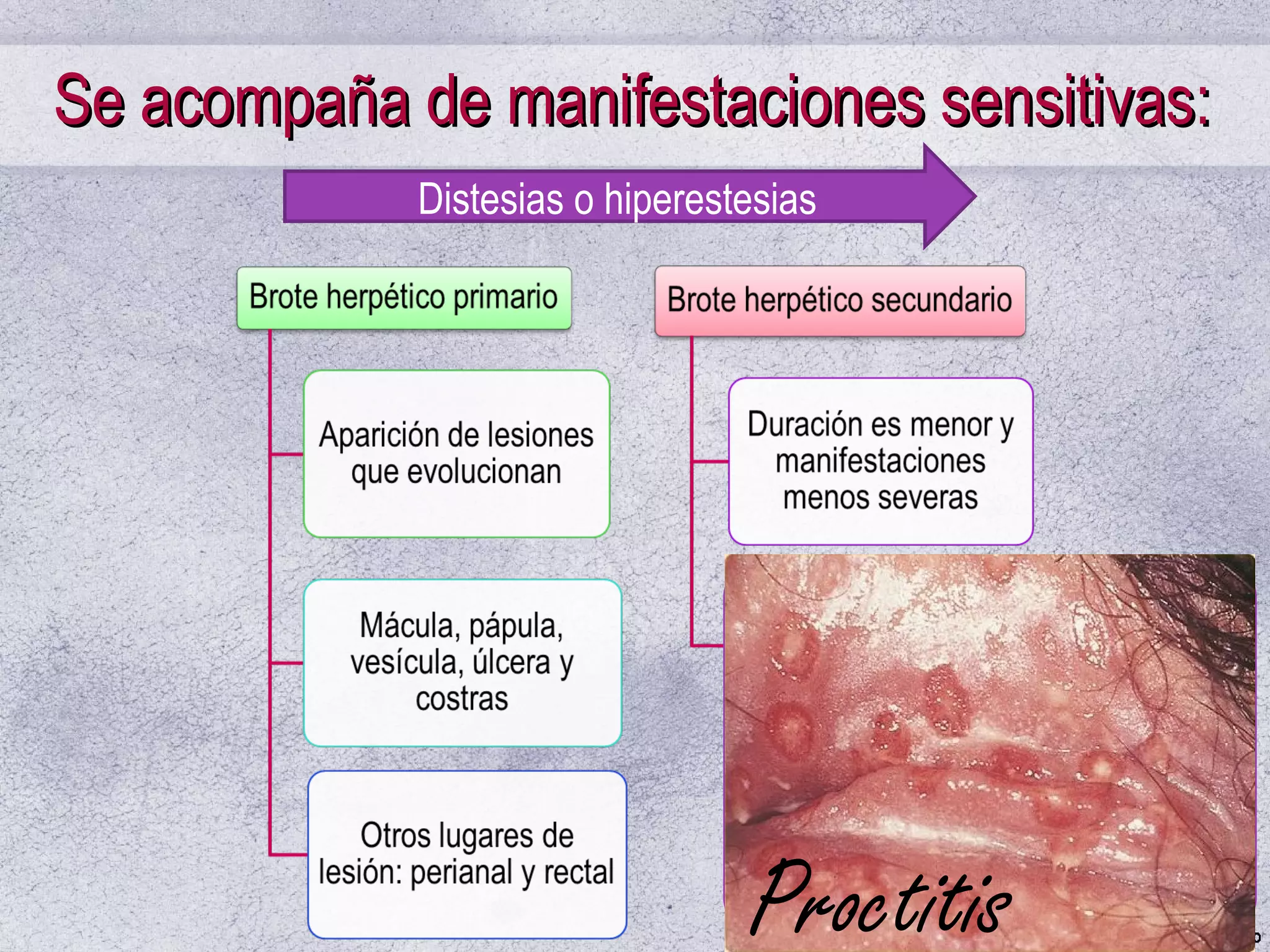 Herpes genital microbiologia clinica | PPT | Infectious Diseases ...