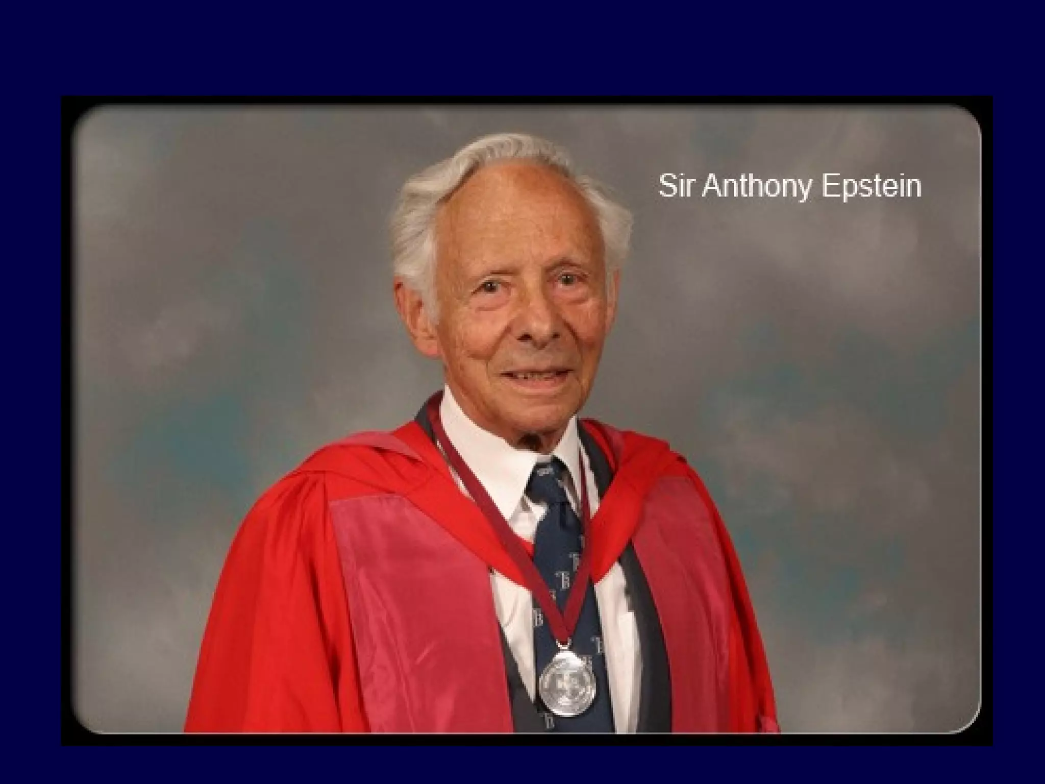 Human Herpesviruses INFECTIOUS MONONUCLEOSIS 2016 | PPT