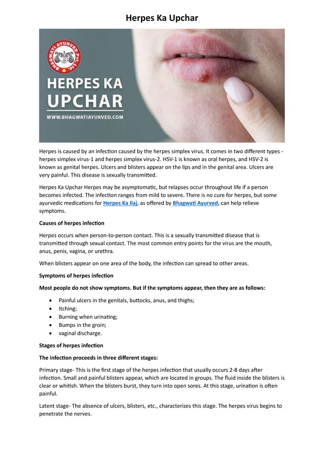 Herpes Ka Upchar.pdf | Infectious Diseases | Diseases and Conditions