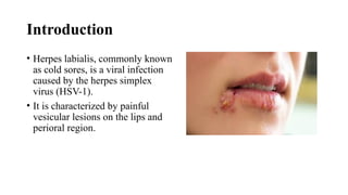 Herpes Labialis : Understanding pathophysiology, Clinical features and treatment | PPT