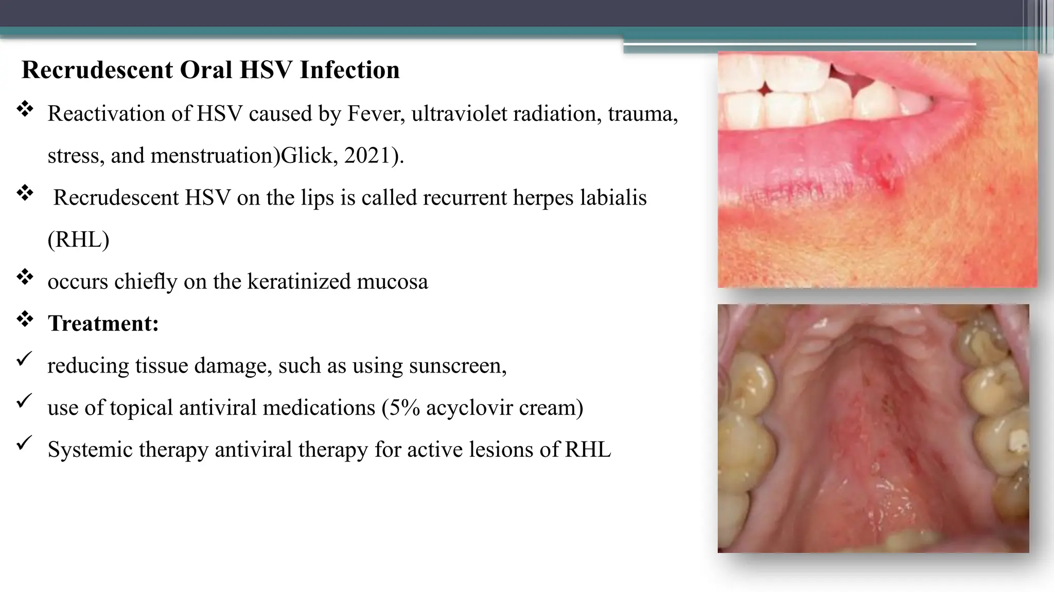 herpes hdjfkgk jfkfkgk jfk presentation.pptx