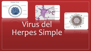 Herpes simple | PPTX