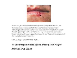 Herpes Simplex 1 | PDF