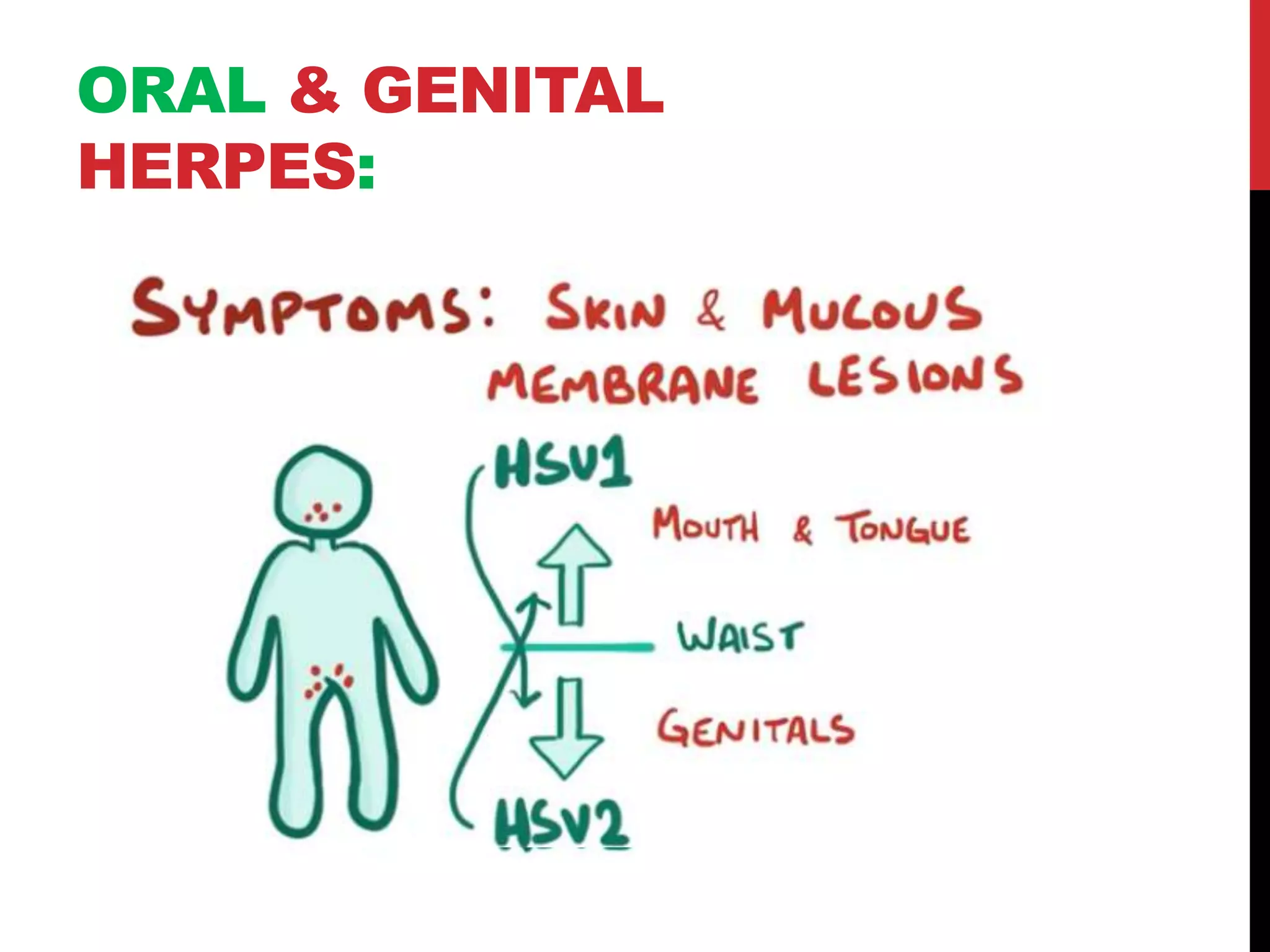 Herpes simplex infection(Hsv) | PPTX
