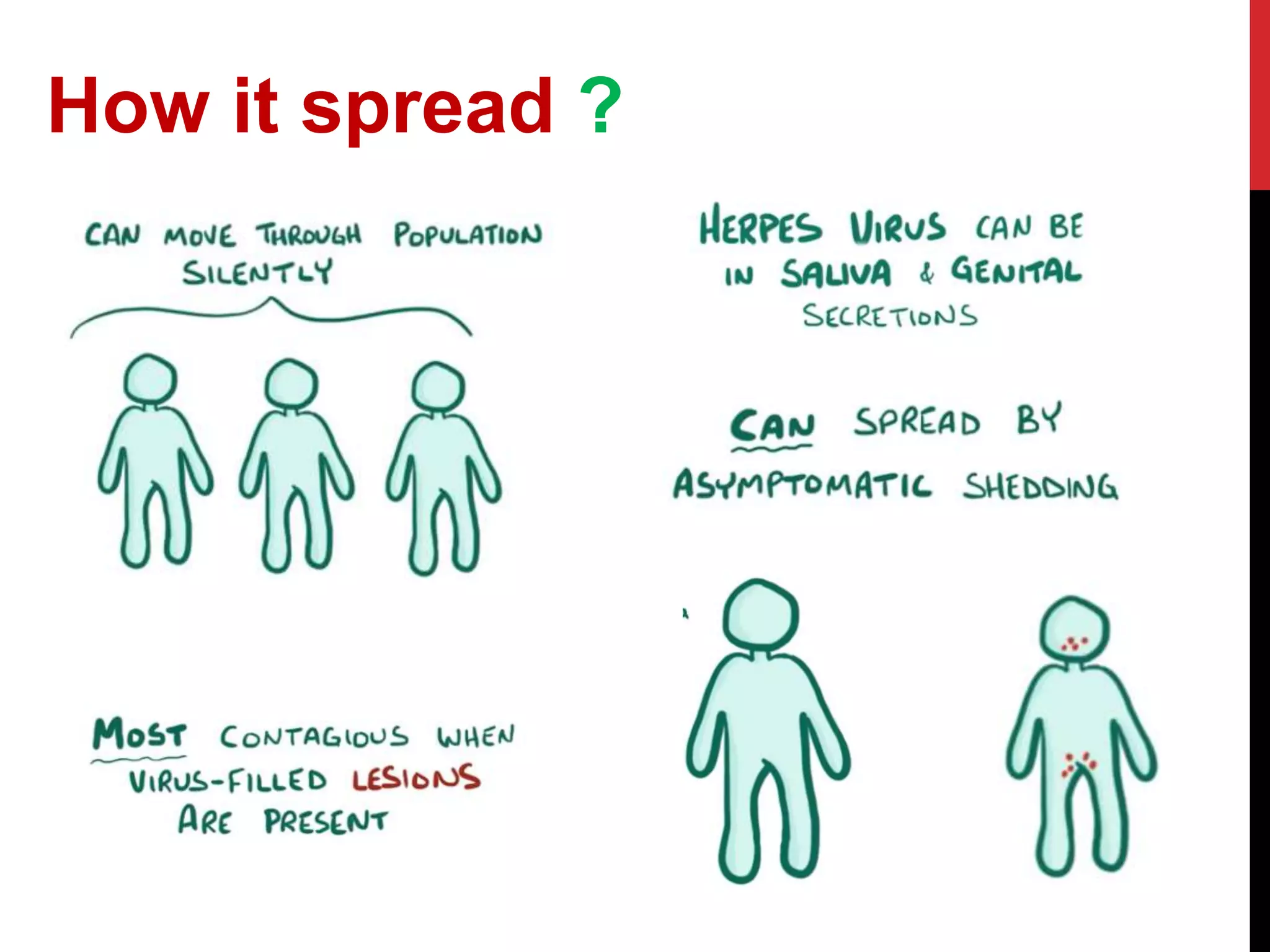 Herpes simplex infection(Hsv) | PPTX