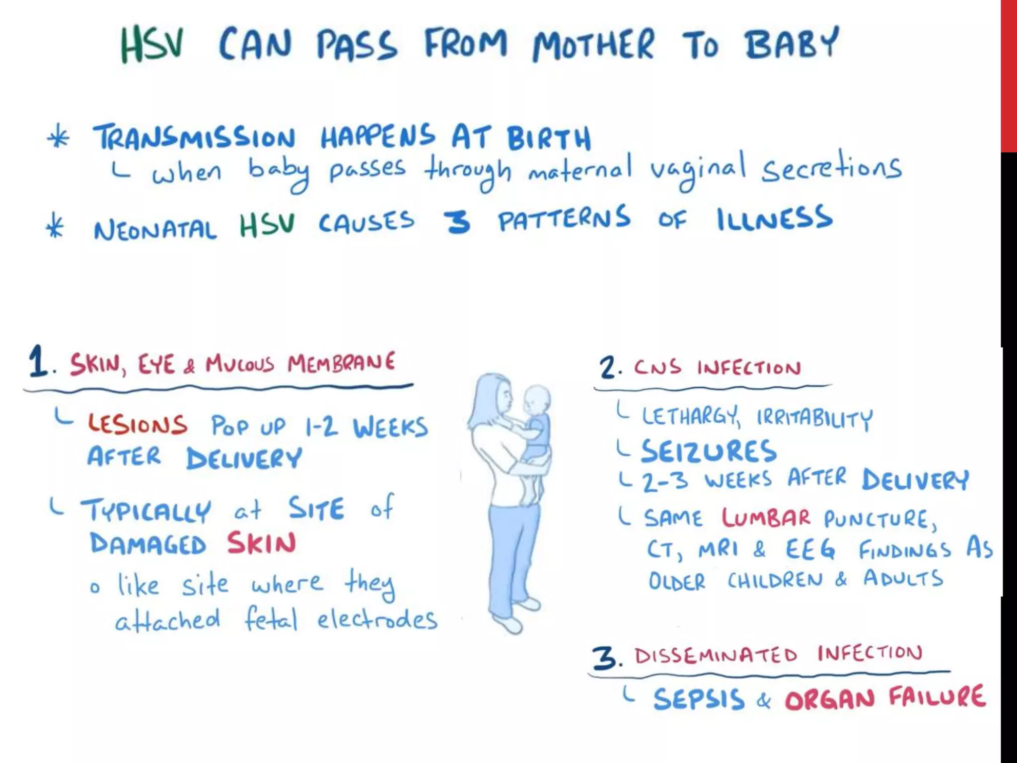 Herpes simplex infection(Hsv) | PPTX