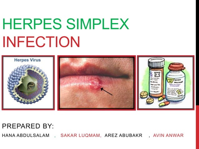 Herpes simplex infection(Hsv) | PPTX | Infectious Diseases | Diseases and Conditions