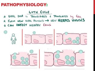 Herpes simplex infection(Hsv) | PPTX