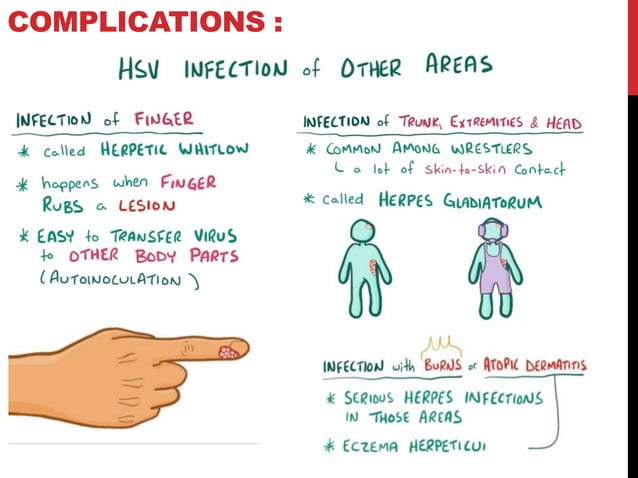 Herpes simplex infection(Hsv) | PPTX | Infectious Diseases | Diseases ...