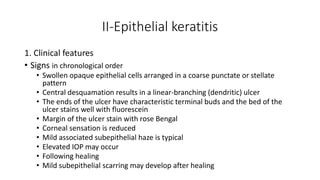 Hsv Dendritic Keratitis Rose Bengal
